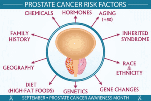 Prostate Cancer Risk Factors and Detection | Kansas City Urology Care